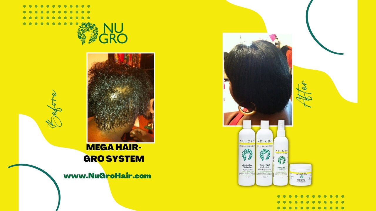 GOOD! Mega Hair-GRO System for Fast Hair Growth (#1 Seller) – NUGRO Hair
